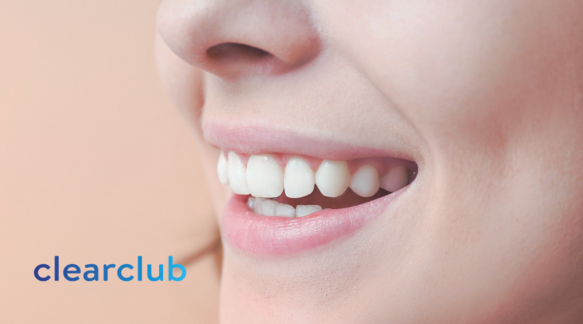 A Bad Bite Can Impact Your Smile — Here's Why – ClearClub